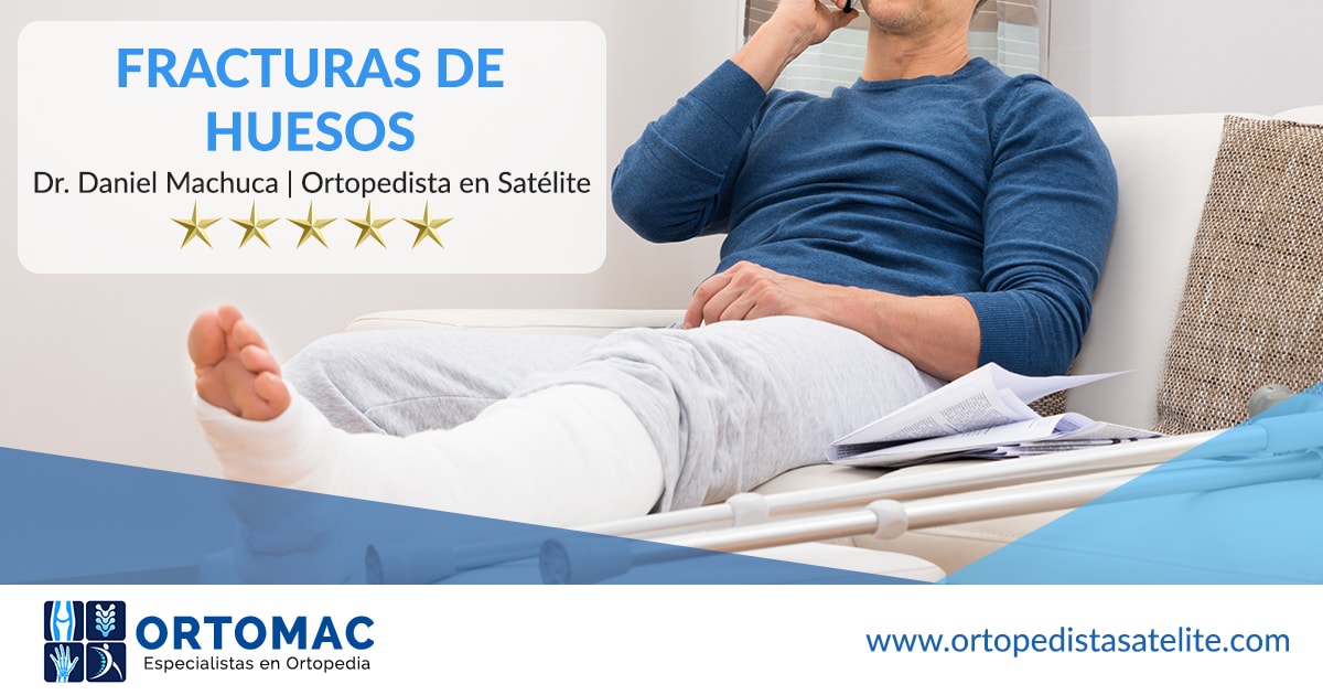 Especialista en Fracturas Simples y Complejas | Dr. Daniel Machuca